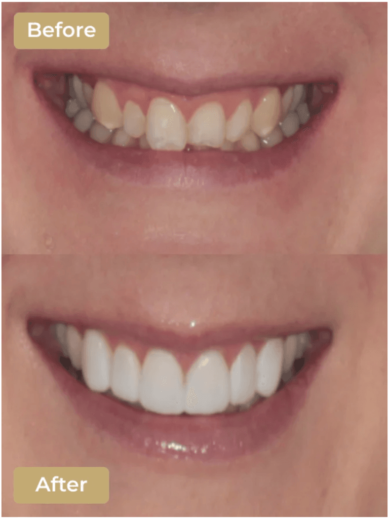 Manor House Dental | Dentist In Birmingham