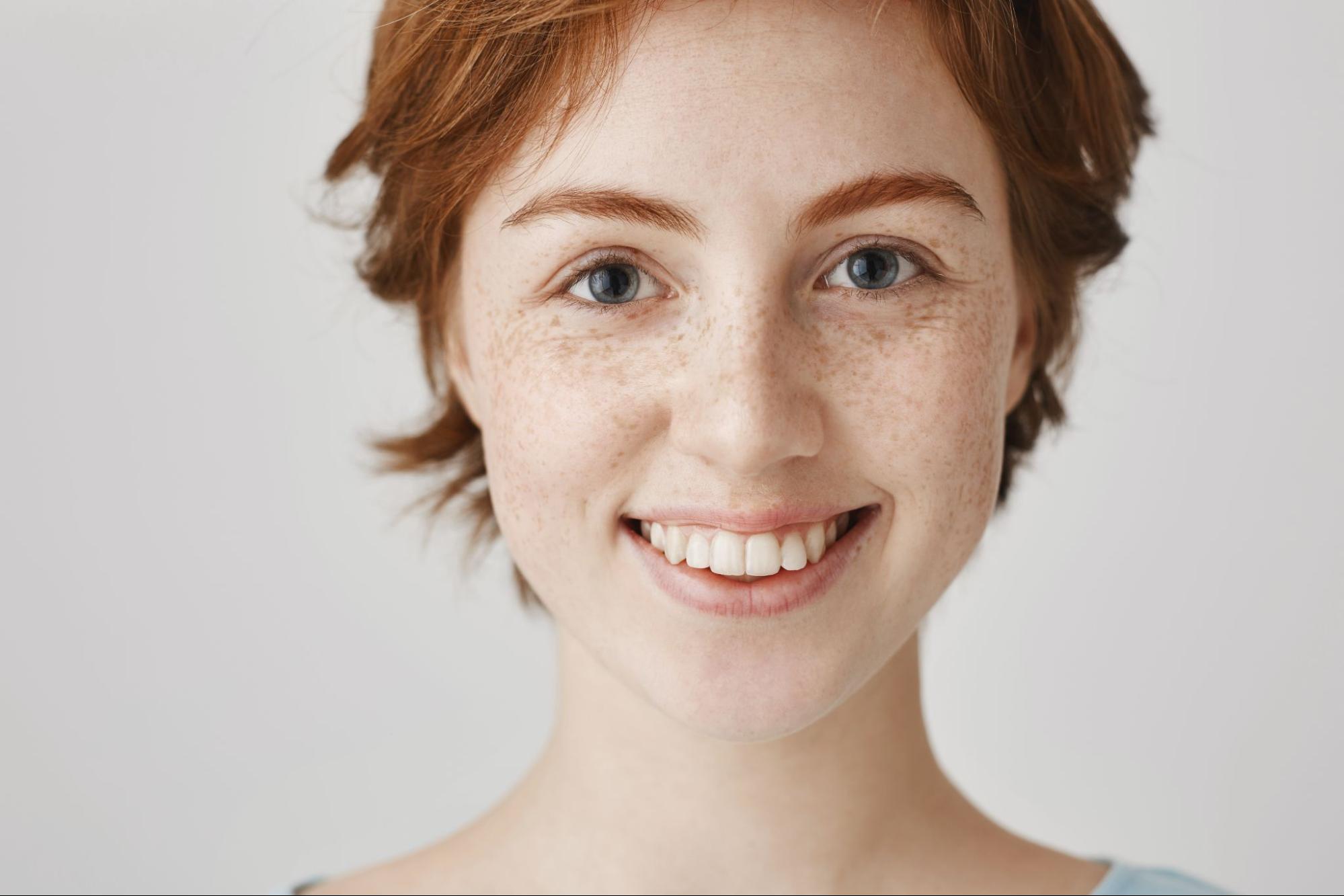 How Quickly Does Composite Bonding Stain? | Manor House Dental Birmingham